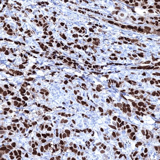 Progesterone Receptor (PR) Antibody (Immunohistochemistry) – Fardadazma