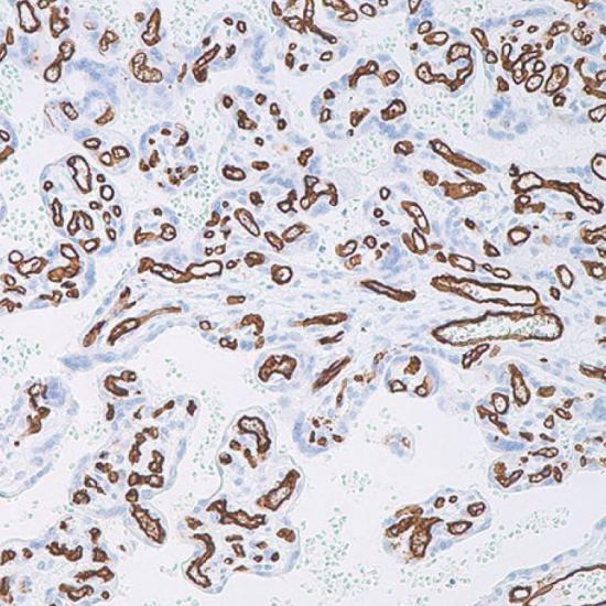 CD34 Antibody (Immunohistochemistry) - Fardadazma
